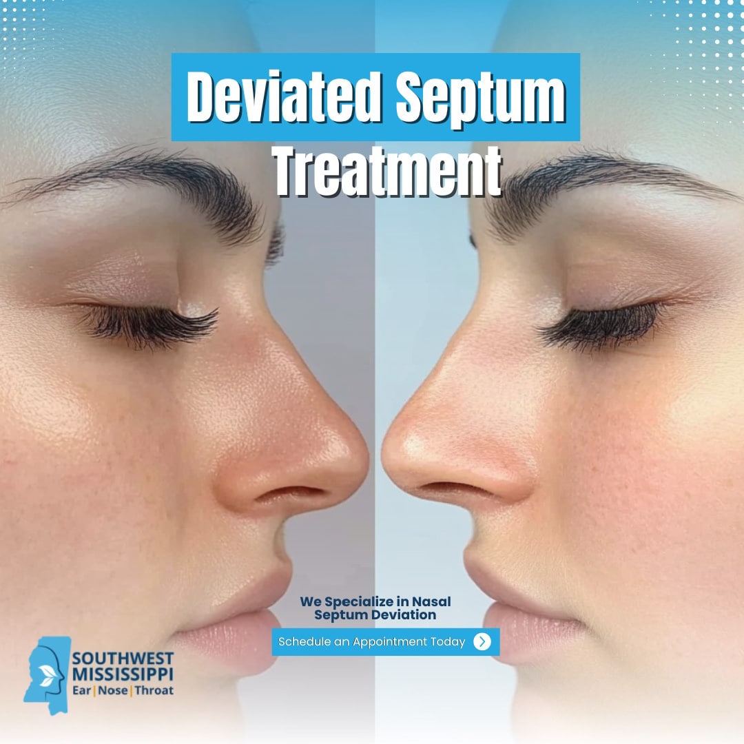 Deviated Septum | Where Expertise Meets Care